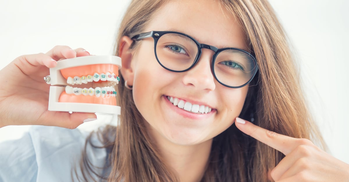 What Are Your Options for Affordable Braces?