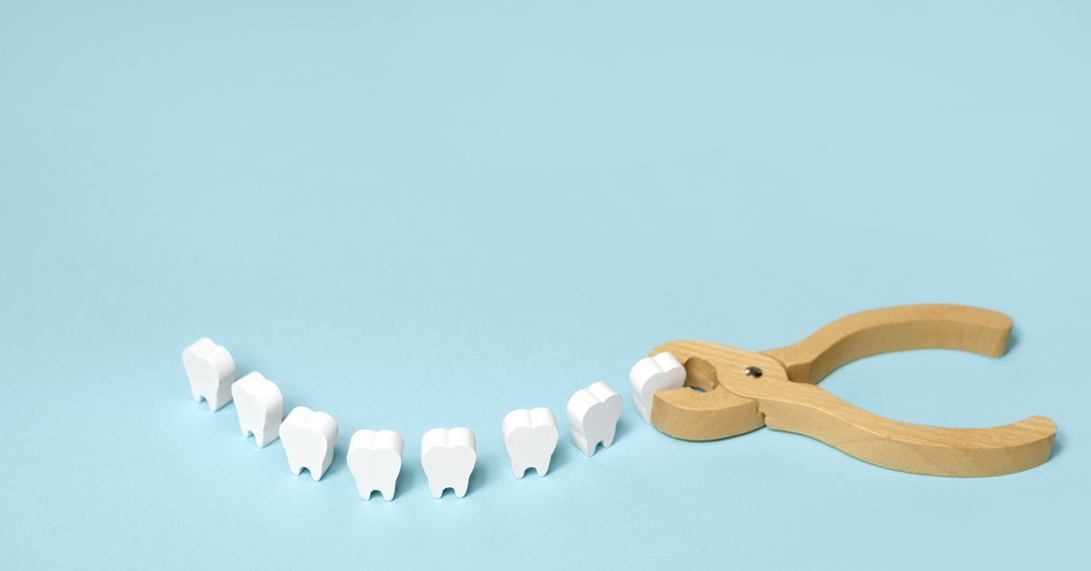 All about wisdom teeth