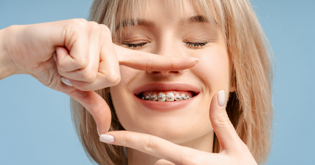 Unlocking Your Best Smile: A Guide to Adult Orthodontics